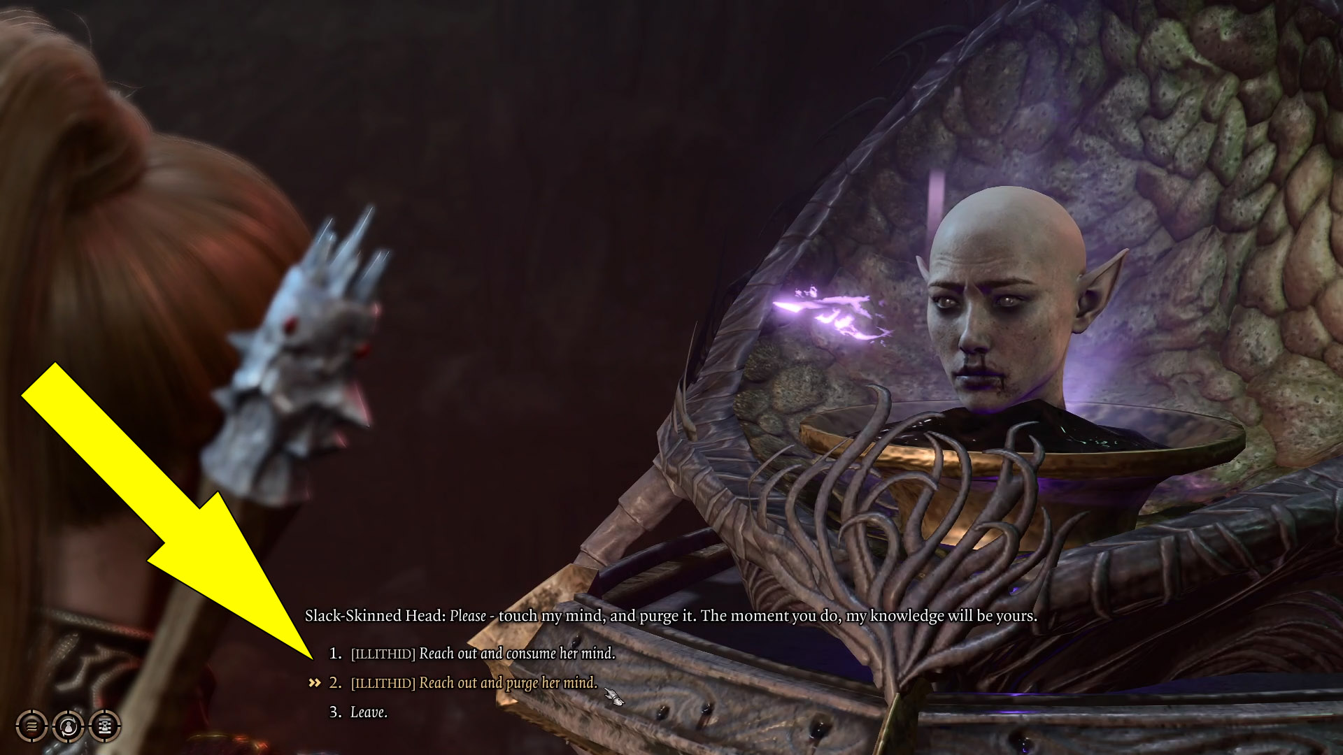 Necrotic Laboratory Brain Puzzle Solution - Baldur's Gate 3